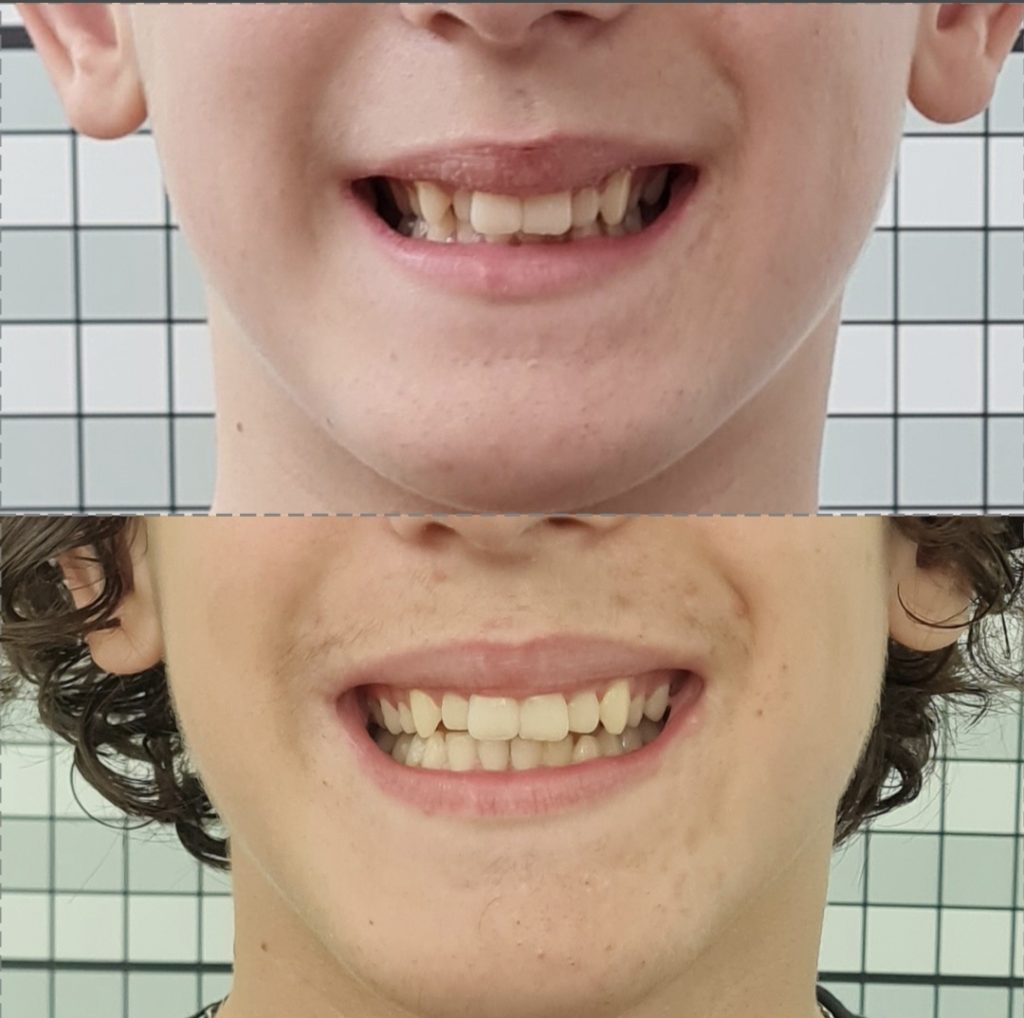 Smile Gallery - Cohen Dentistry