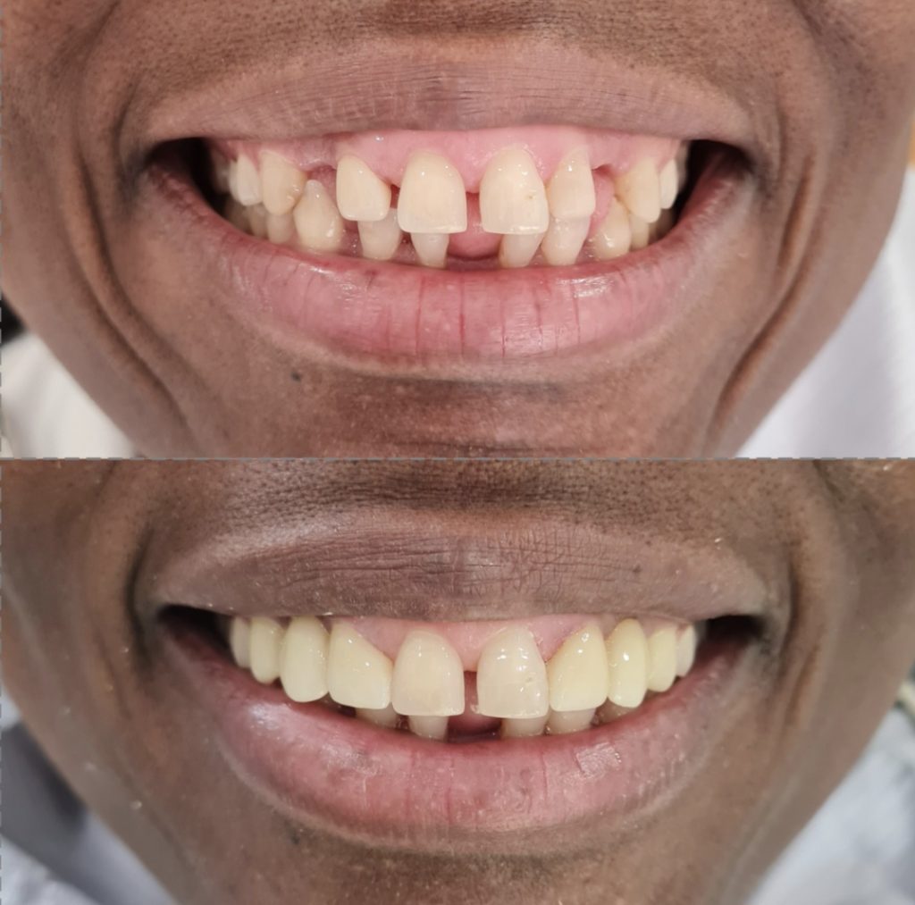 Smile Gallery - Cohen Dentistry