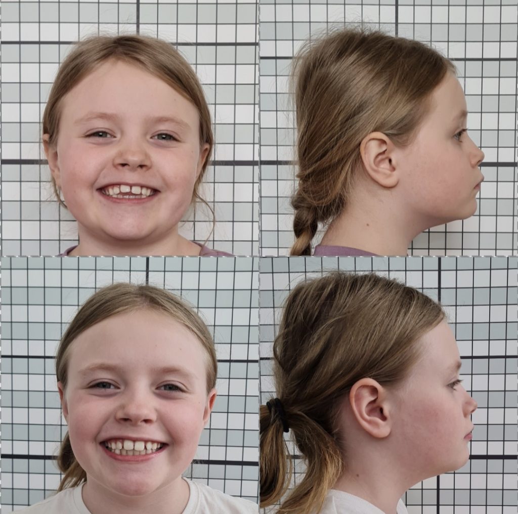 Smile Gallery - Cohen Dentistry